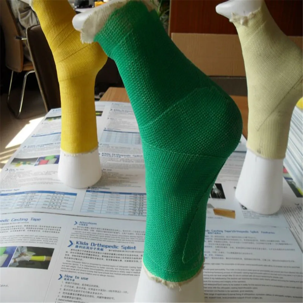 China Manufacturer Medical Bone Fracture Plastic Orthopedic Fiberglass ...