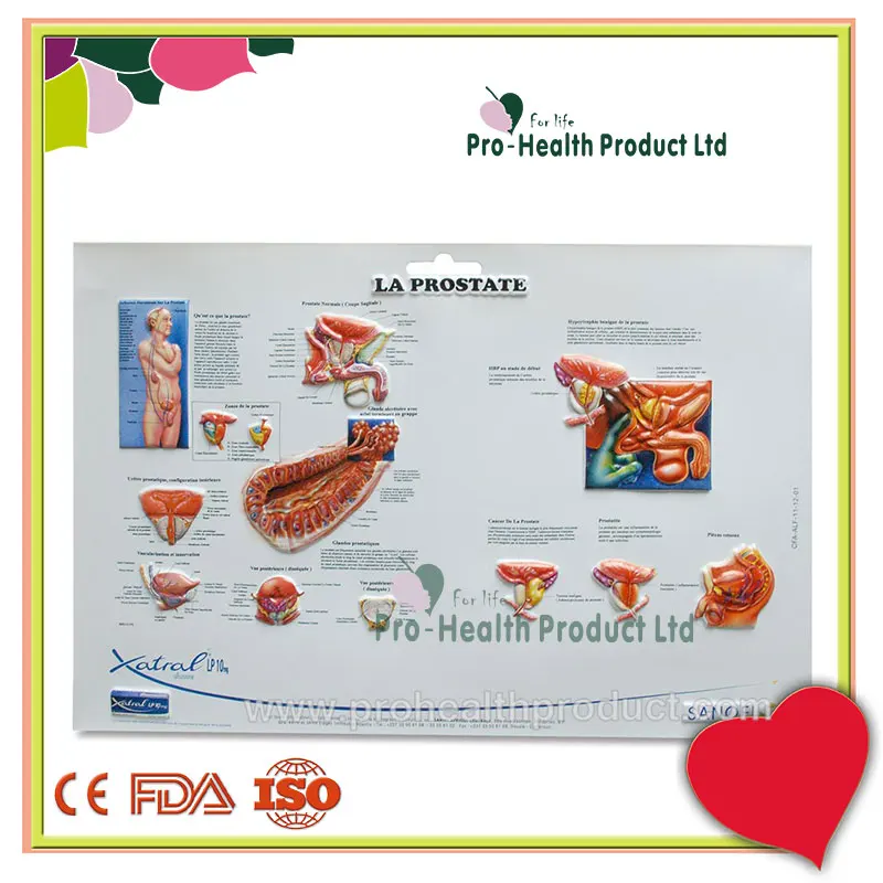 Prostate 3d Medical Human Anatomical Wall Chart - Educational