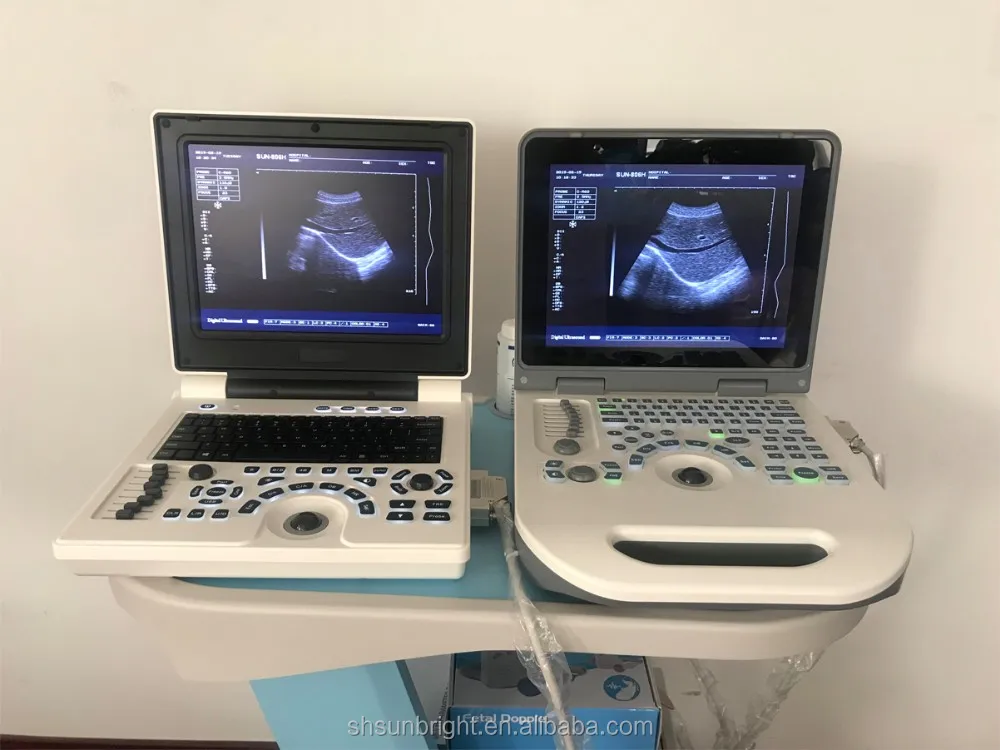 Ultrasound Mini Best Veterinary Usg Ultrasound Scanner - Buy Ultrasound ...