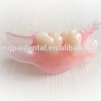 Dental Valplast Material Flexible Denture Material/elastic Denture ...