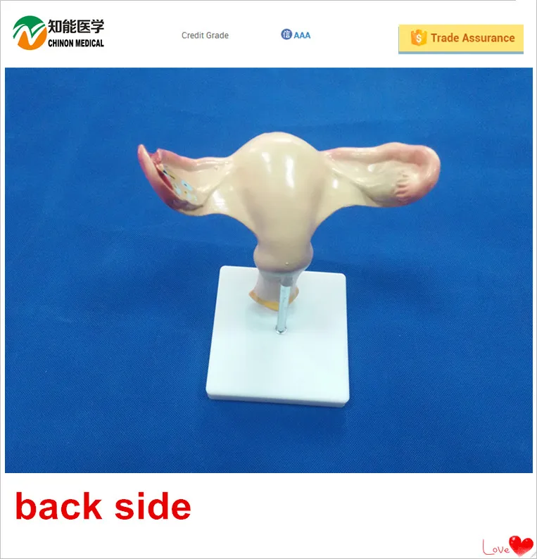 Hidup-ukuran Anatomi Rahim Perempuan Model Plastik - Buy Model Rahim ...