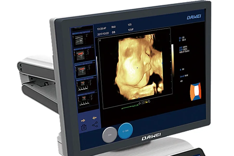 4d Ultrasound Scanner Machine With Color Doppler For Sale To Fibroscan ...