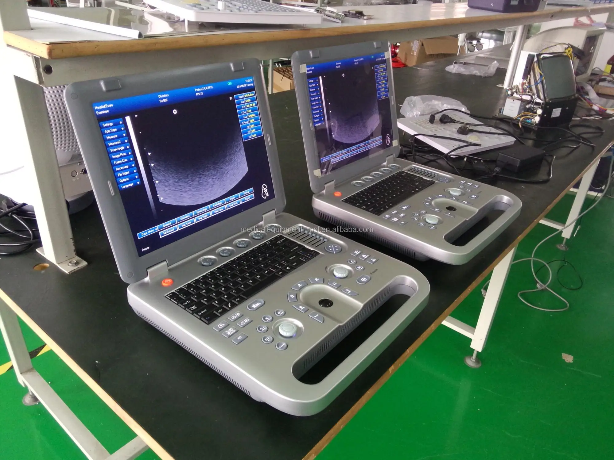 New And Best 3d&4d Portable Ultrasound Machine Used In Human And Vet ...