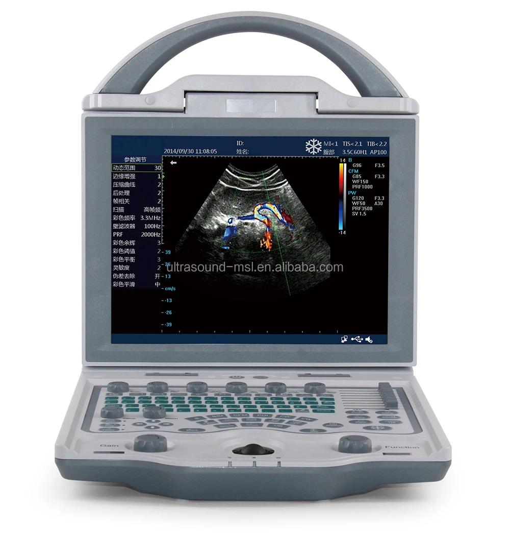 New Portable Led Human Ultrasound Scanner Mslpu27 On Promotion - Buy ...