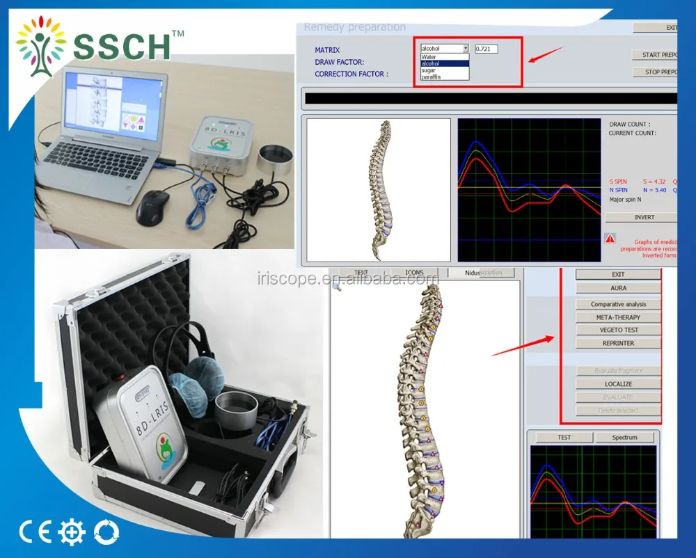 Resonance Sonar Scanner 8D Nls/Cell Health Analyzer Hot Sale(id ...