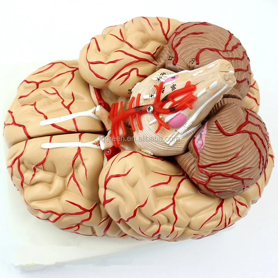 Brain Epilepsy Model - Buy Pathological Brain Model,Human Brain ...