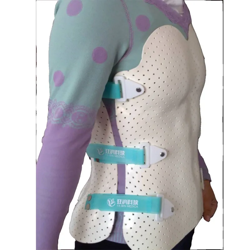Thermoplastic Orthopedics Immobilization Scoliosis Splints Prevent ...