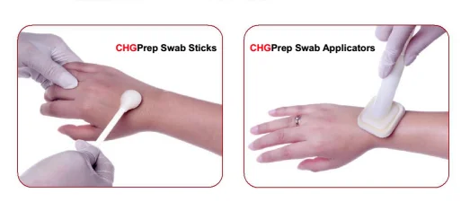 2% Chg 70% Ipa Antiseptic Medical Swab For Patients Pre-injection ...