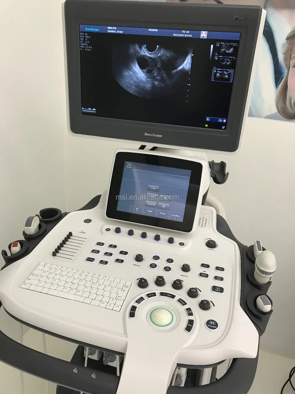 Smart Color Trolley Ultrasound Machine, SonoScape S40 Doppler| Alibaba.com