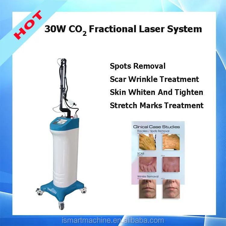 Fractional Co2 Laser Stretch Mark Removal Beauty Machine For Skin ...