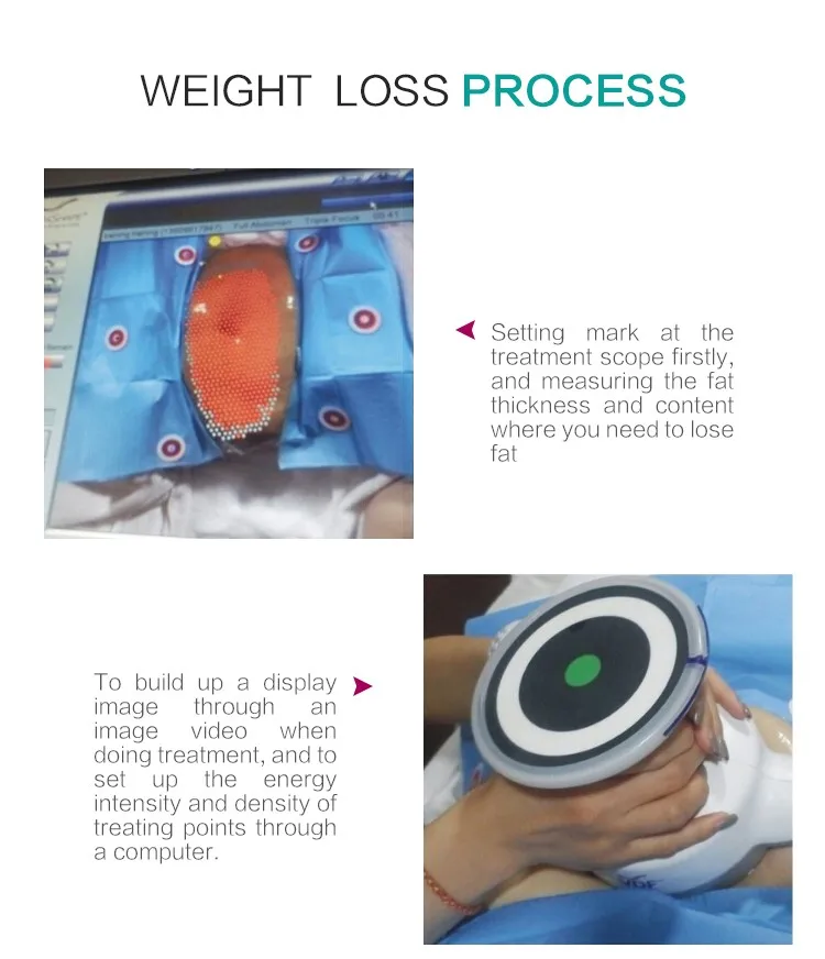 Ultrasharp Fat Melting Machine,Simple,Easy,Fast And Permanent - Buy ...