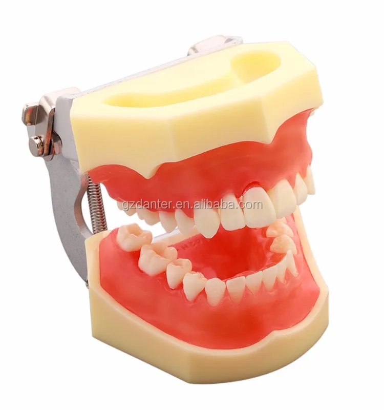 New Hot Sale Periodontal Model For Demonstrating Periodontal Disease ...