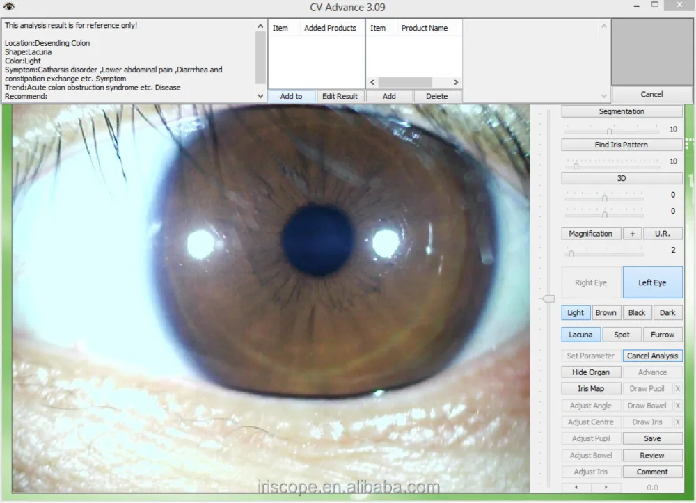 Portable Health Scope Analyzer Eye Iriscope Iridology Camera 5mp Pro ...
