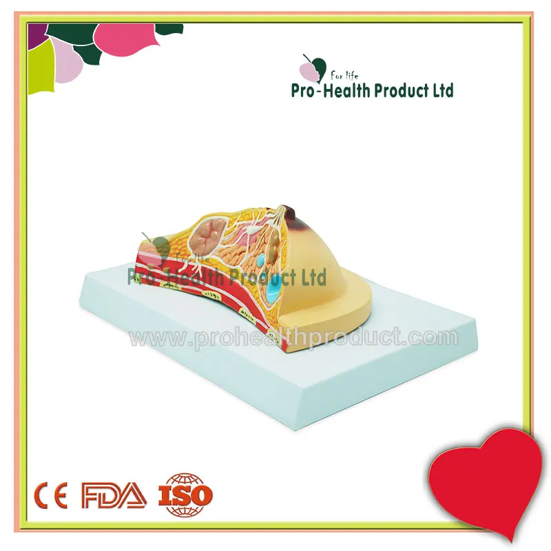 Breast Pathology Lesion Disease Anatomy Model - Pro-health