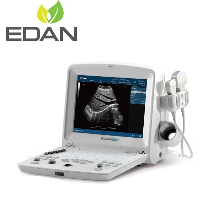 Edan Ultrasound Machine /ultrasound Portable Edan Dus60 For Vet - Buy ...