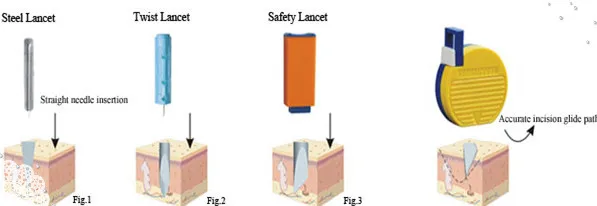 For Newborns The Penetration Depth Of Lancets For Blood - Buy Safety ...