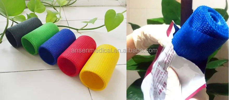 Medical Ortho Fiberglass Cast Colors Supplies Orthopedic Casting Tapes ...