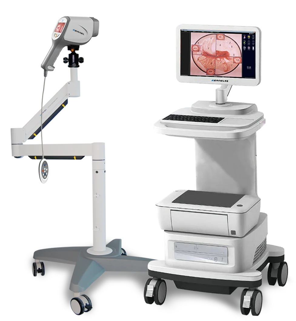 Full Hd Sony Camera Digital Video Colposcope Endoscopic Camera For ...