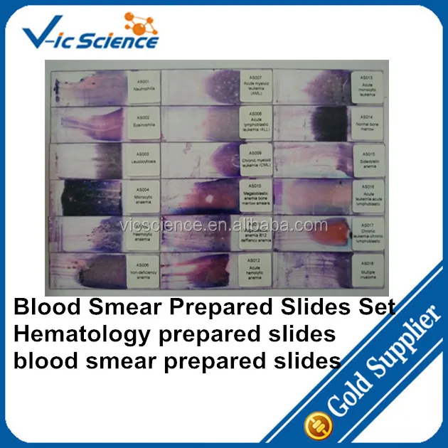 Hematology Prepared Slides,Blood Smear Prepared Slides,Blood Smear ...
