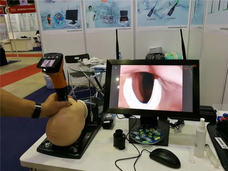 Anesthetic Intubation Video Laryngoscope Difficult Airway - Buy ...