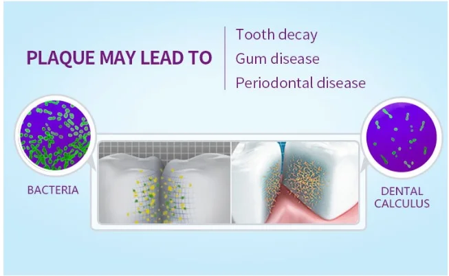 Plaque Disclosing Tablet For Teeth Health Care - Buy Disclosing Tablet ...