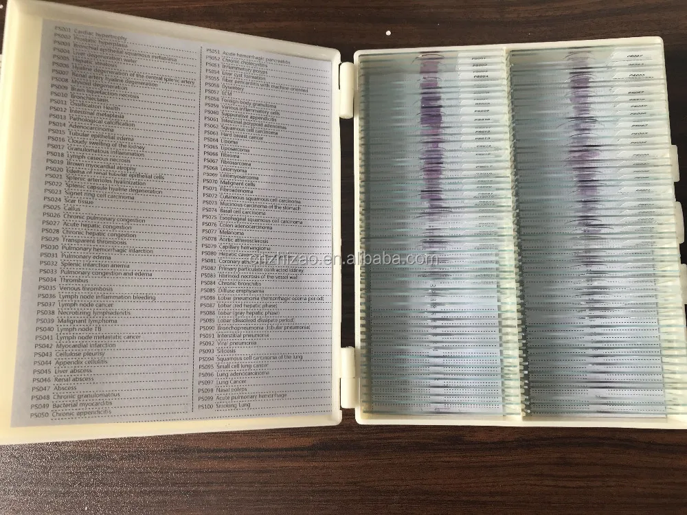 Professional 200 Pieces Set Microscope Human Pathology Prepared Slides ...