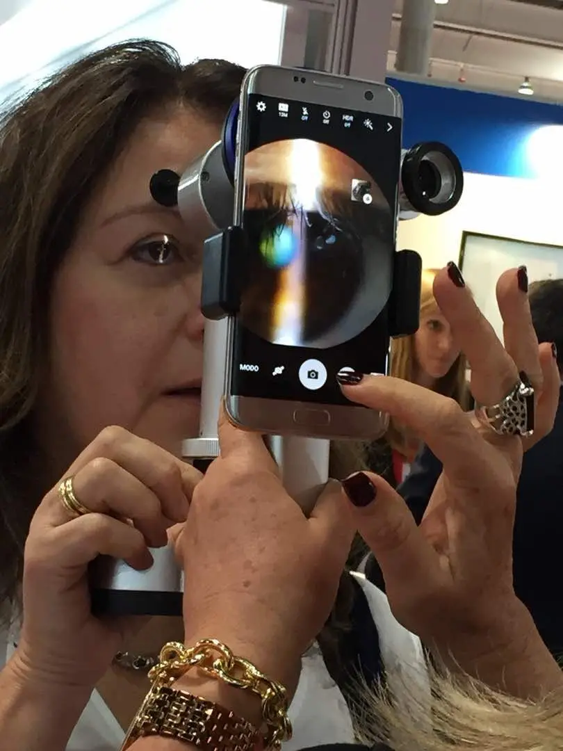 Universal Smartphone Photo Adapter For Slit Lamp - Buy Mobile Phone ...