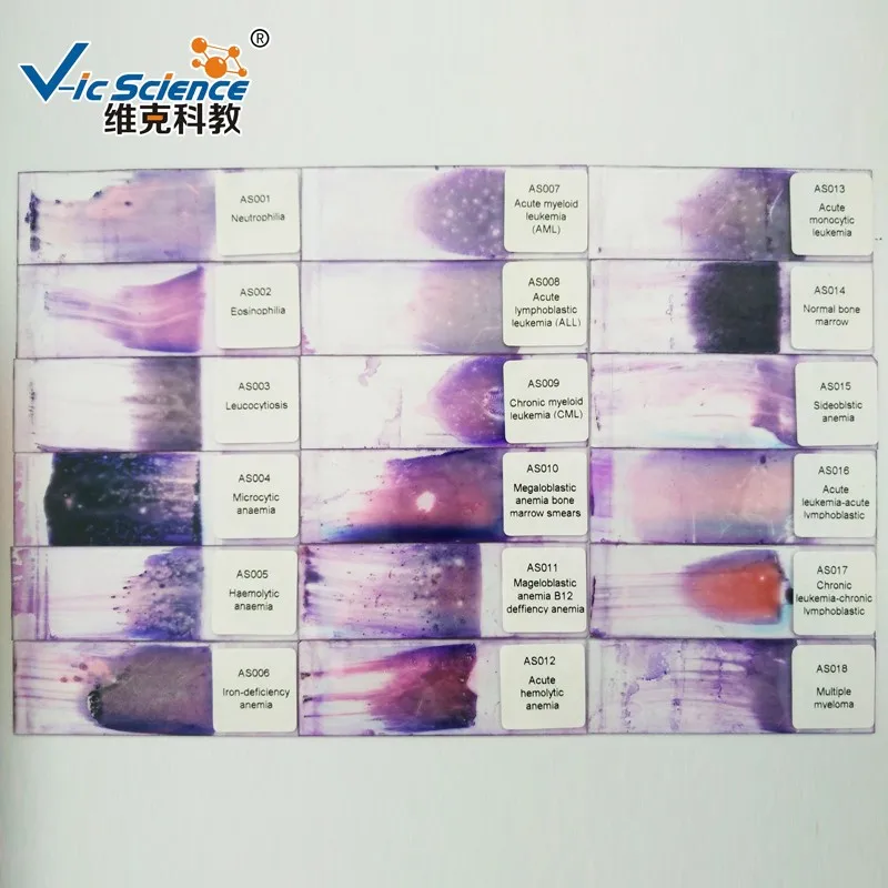 Hematology Prepared Slides Blood Smear Prepared Slides Types Of ...