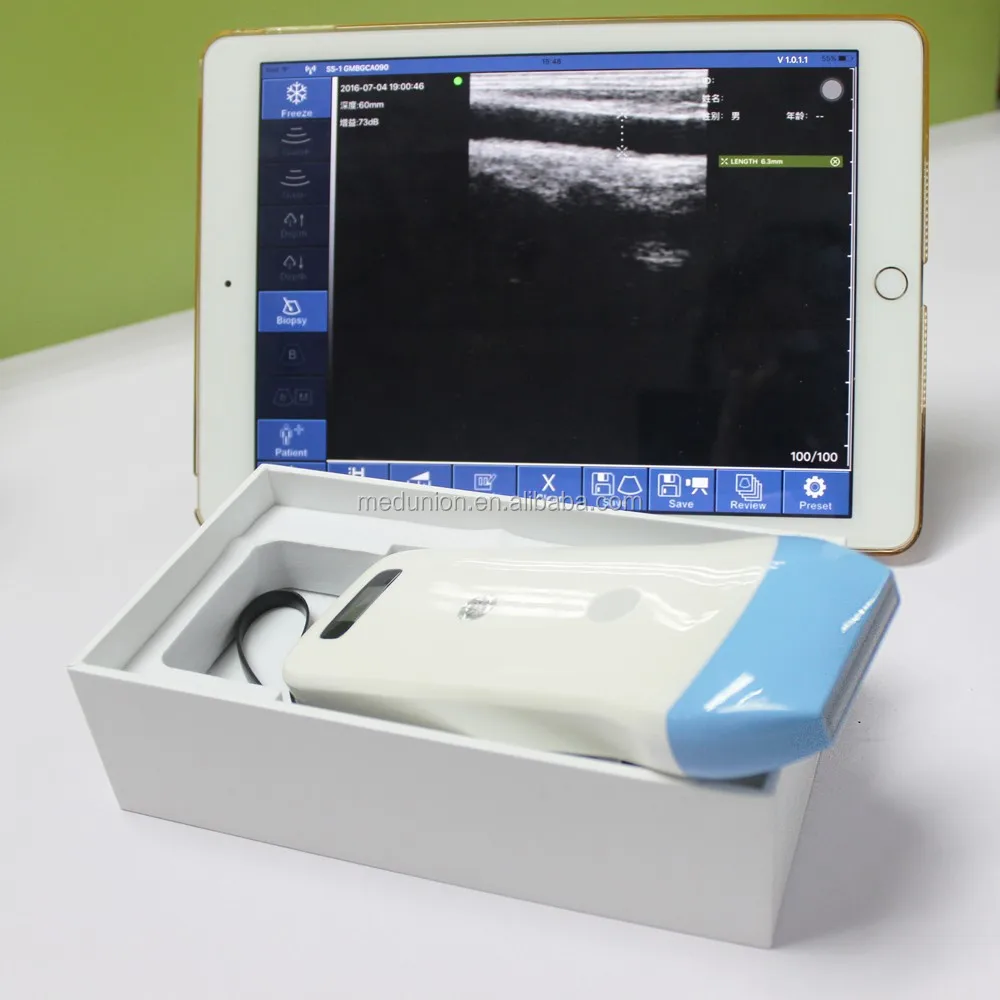 Mslpu41 Portable Mini 80elements Linear Wireless Ultrasound Machine ...