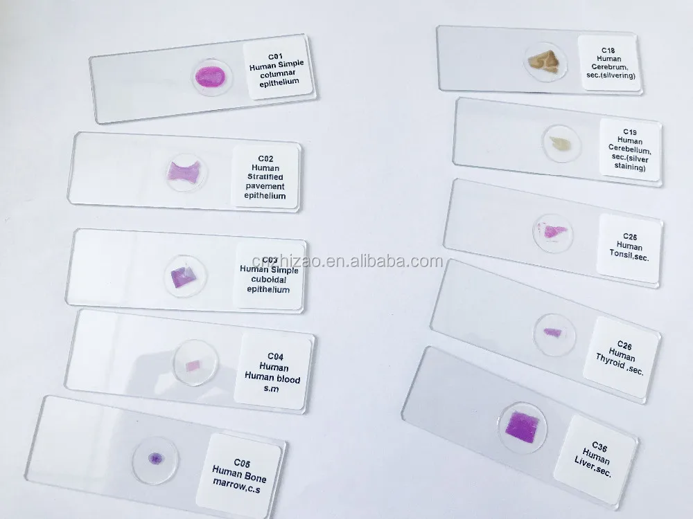 Professional 200 Pieces Set Microscope Human Pathology Prepared Slides ...