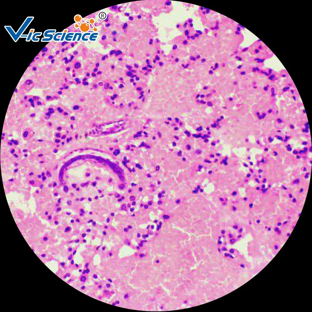 Medical Science Parasitology Combination Set - Microscope Slides for ...