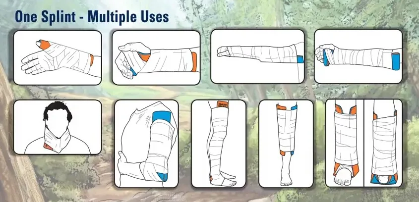 36" Rolled Sam Splint Immobilise Broken Bones Sprain Injuries Leg Arm Shin Splint Roll - Buy Sam ...