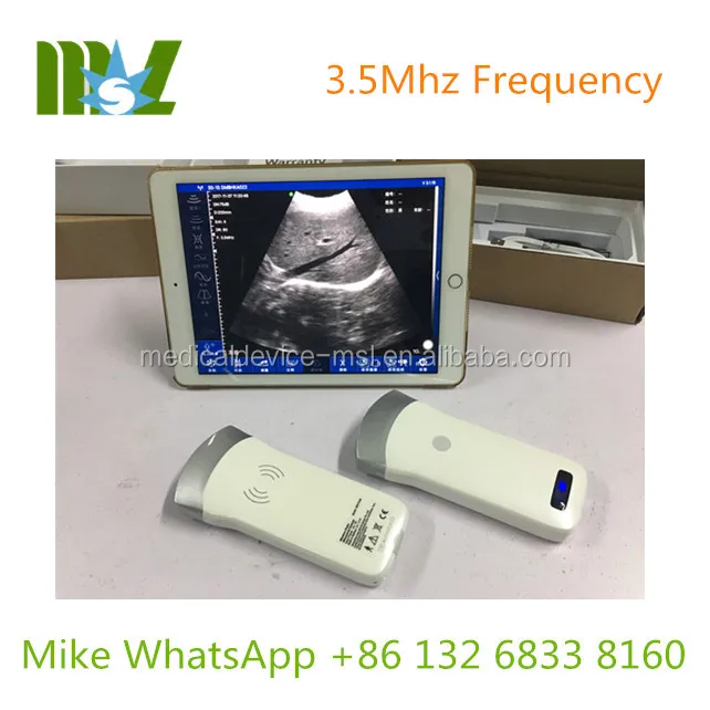 Mini Ultrasound Machine & Wireless Portable Ultrasound Mslpu31 - Buy ...