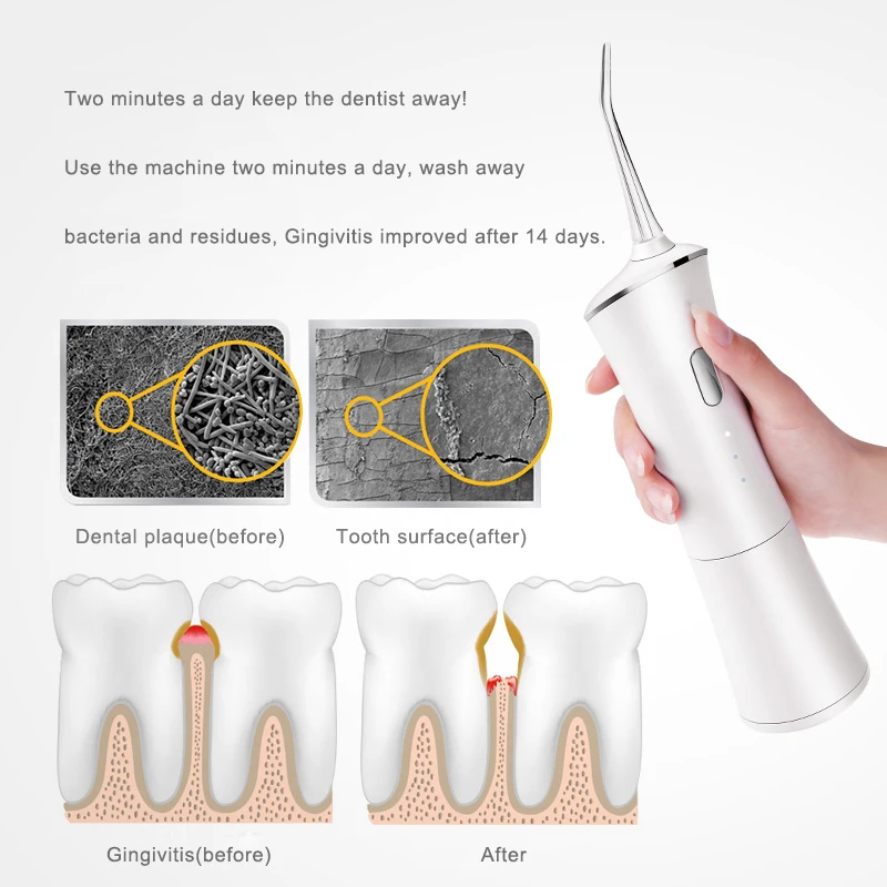 Hot Selling Teeth Cleaning Machine Dental Instrument Teeth Washing ...