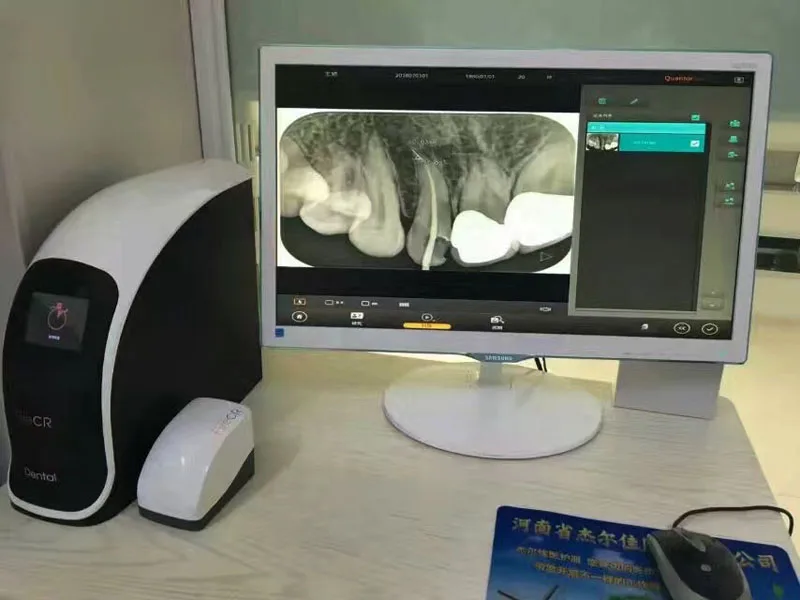 Ce Approved High Resolution 3disc Digital Imaging Dental X Ray Scanner ...