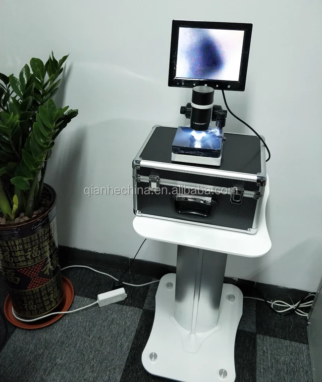 Latest Medical Microcirculation Nailfold Capillaroscopy Machine, High ...