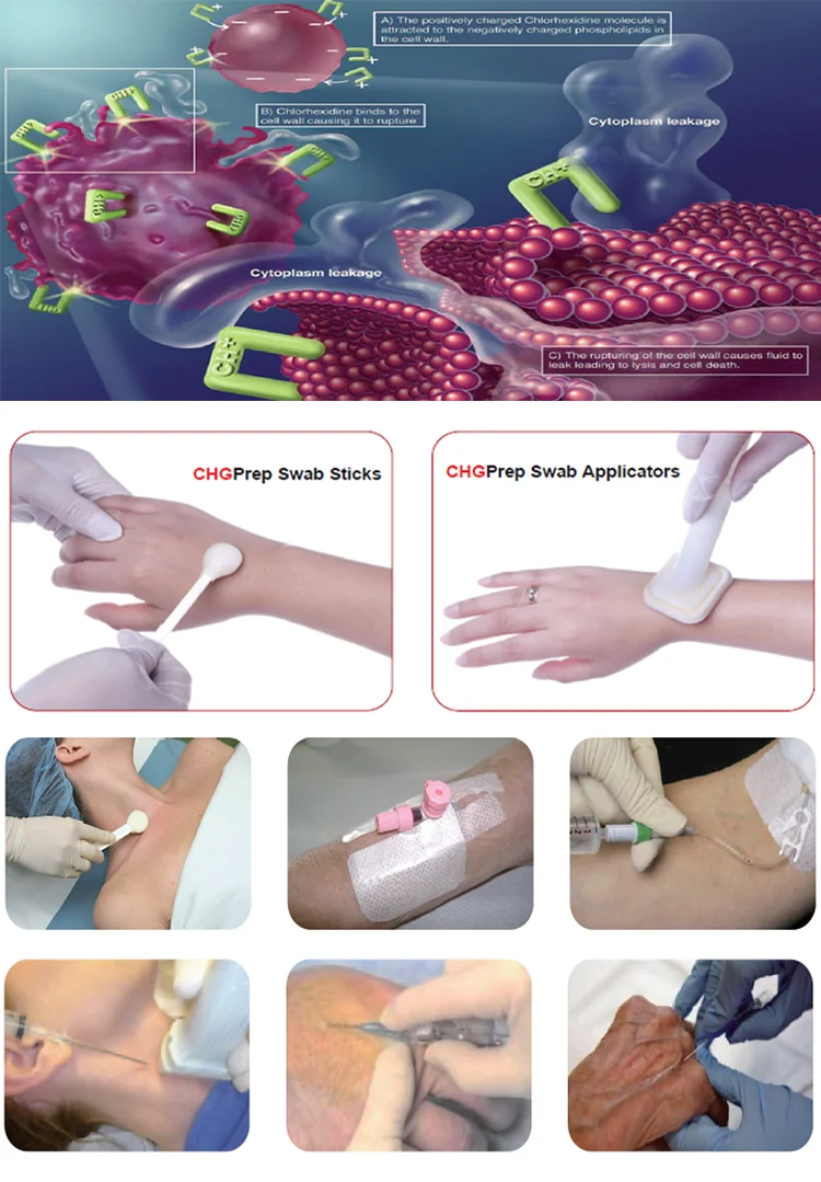 70% Ipa Isopropyl Alcohol And 2% Chlorhexidine Gluconate Skin Prep ...