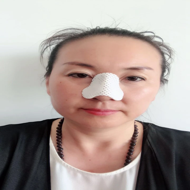 Thermoplastic External Nasal Splint Sheets For Orthopedic Rhinoplasty ...