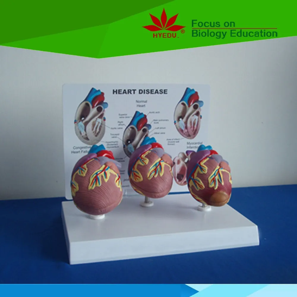 Heart Teaching Anatomical Model for Medical School Use| Alibaba.com