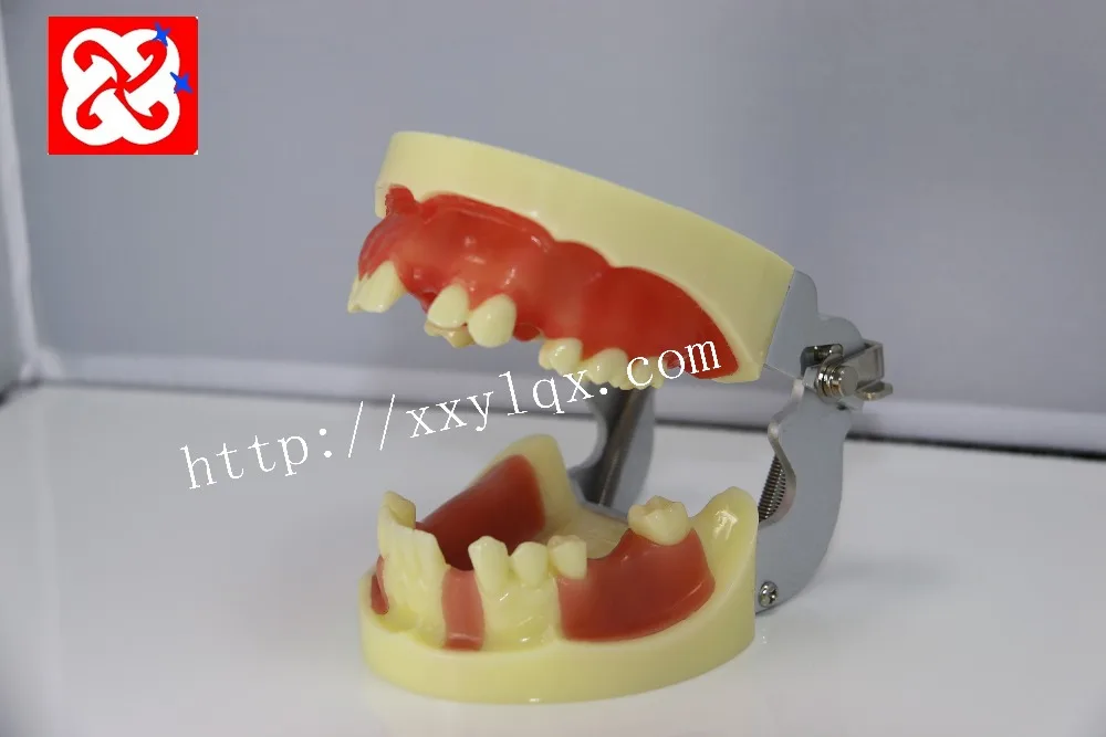 Edentulous Implant Practice Model - Advanced Dental Training
