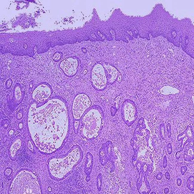 Teaching Aid 50pcs Human Pathology Slides Set For Microscope - Buy ...