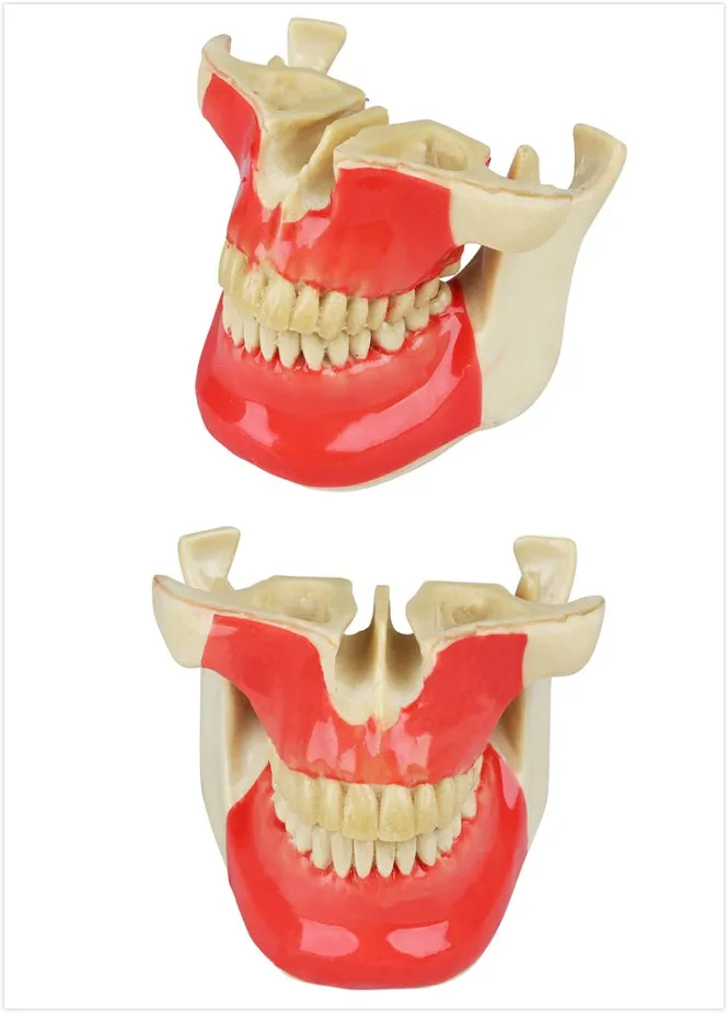 Good Quality Ortho Implant Practice Jaw Model Dental Implant Model