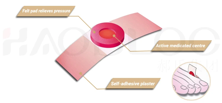 Clavus Relief Stickness Corn Plaster/medical Plaster - Buy Foot Corn ...