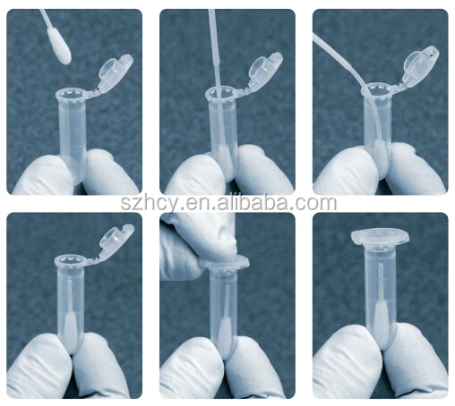 Flocked Swab Sample With The Use Of Nasopharyngeal Aspirate (npa ...