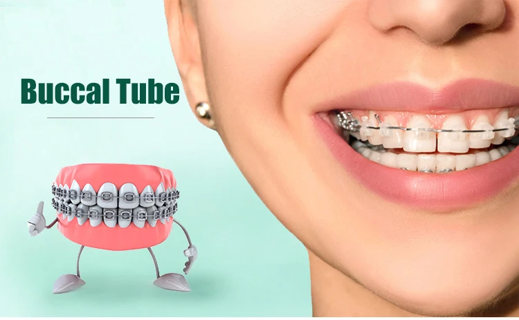 Dental Orthodontic Bondable Convertible Buccal Tube First Molar Tube ...