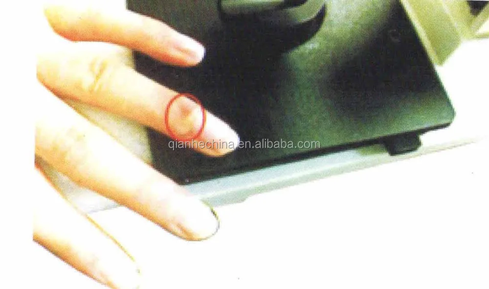Portable Nailfold Capillaroscopy Microcirculation Test Machine, High ...