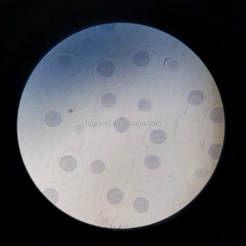 Human Oral Pathology Medical Pathology Prepared Slides - Buy Tooth ...