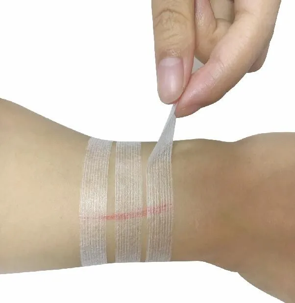 Wound Skin Closure Strips - Transparent Medical Materials