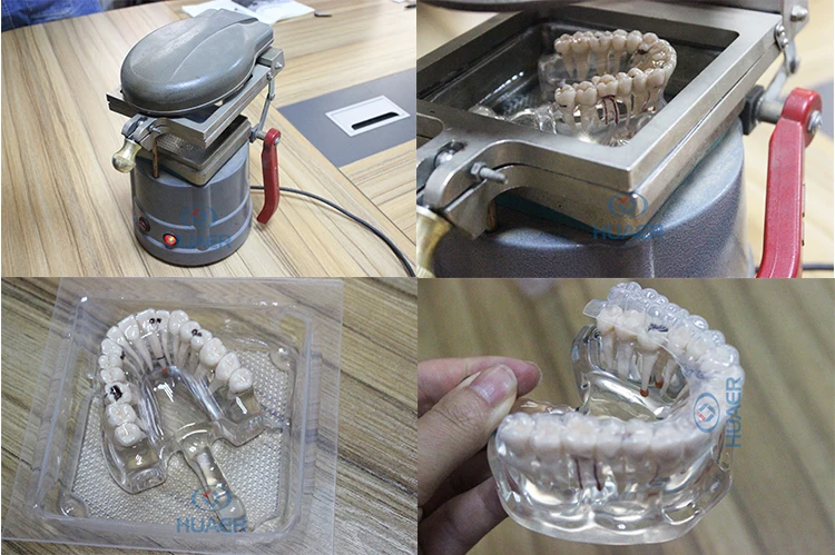 Dental Hard Vacuum Forming Sheets: ABS PVC Plastic Orthodontic ...