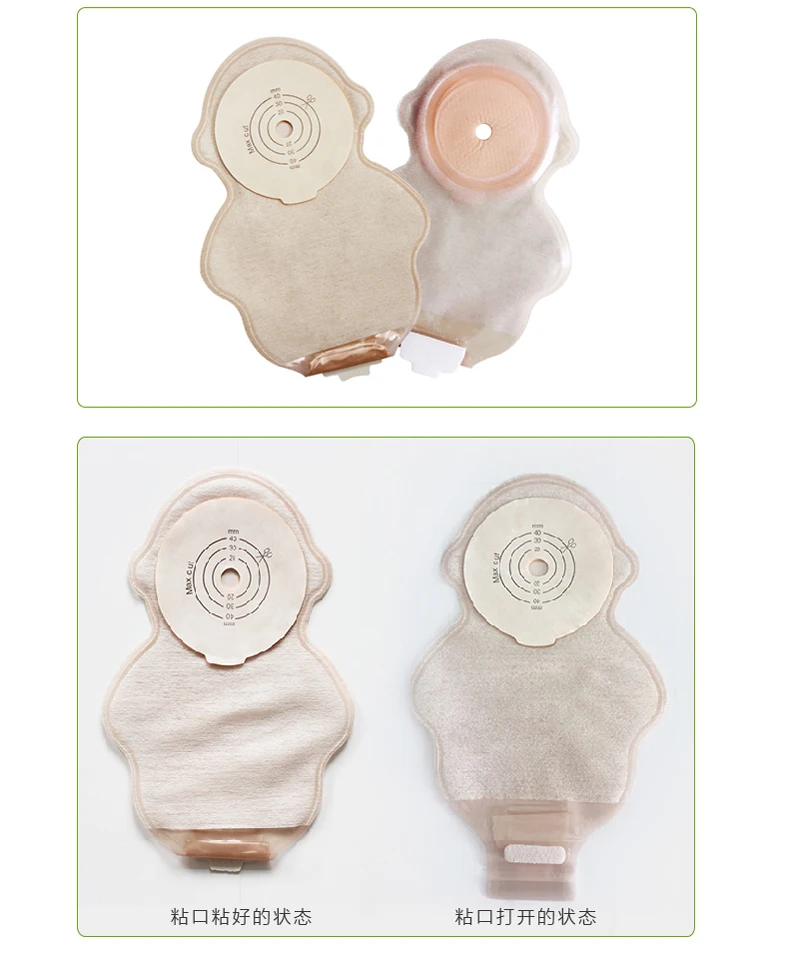 Steadlive Mini Pediatric Ostomy Bag - Buy Pediatric Ostomy Bag,Ostomy ...